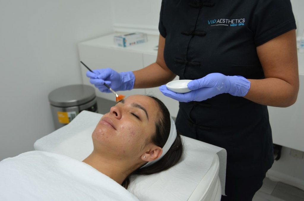 Chemical Peels | VIP Aesthetics - Fort Lauderdale, FL
